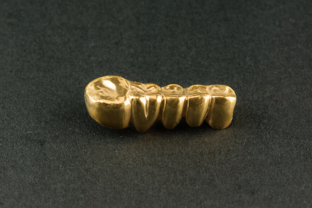 All About Gold Tooth Implant - Weaverville Family Med
